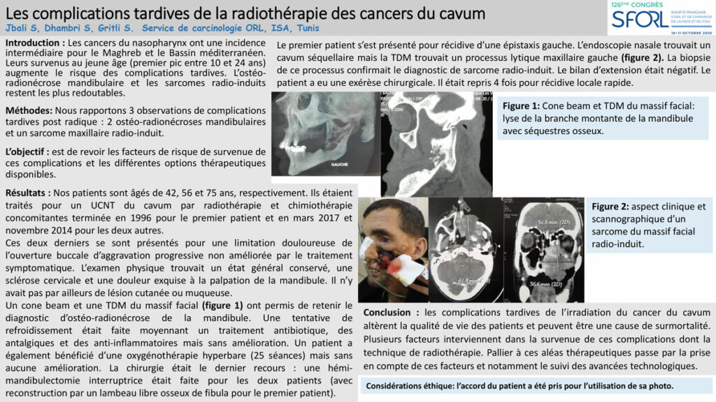 Les complications tardives de la radiothérapie des cancers du cavum ...