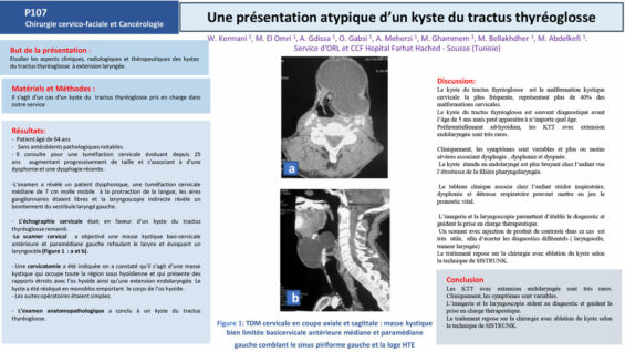 Une présentation atypique d’un kyste du tractus thyréoglosse – La ...