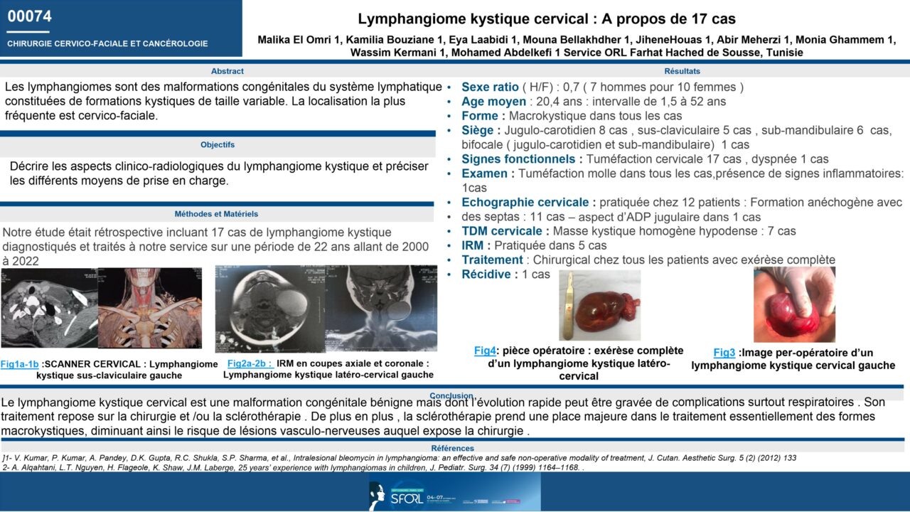 Lymphangiome kystique cervical : A propos de 17 cas – La médiathèque de ...